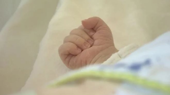 Едно от бебетата станали жертва на коклюш е постъпило с белези на