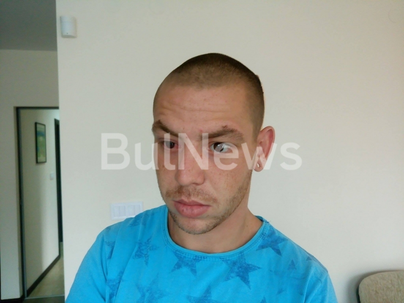 Брутално полицейско насилие Ченгета пребили зверски младеж във Врачанско ужасяващи снимки